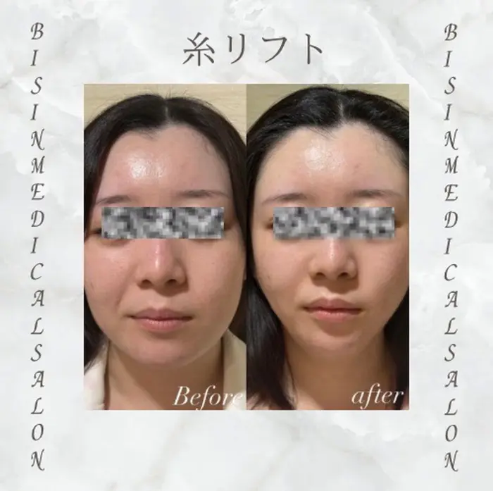 新宿南口 まど(BISIN MEDICAL salon所属)のメニュー｜ミニモ