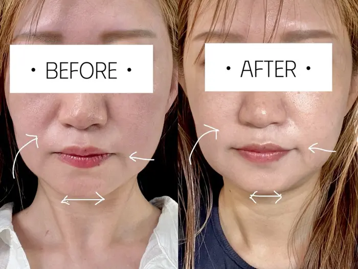 Shine'an Mari(Shine'an所属)のエステ・リラク・エステティシャン情報｜ミニモ