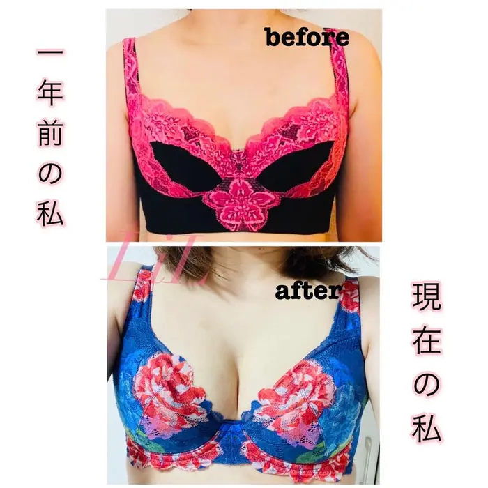 恥ずかしながら、私のビフォーアフターです元々自分のバストにコンプレックスあり。一年でここまで成長|バストアップ&小顔矯正専門サロン Lil所属