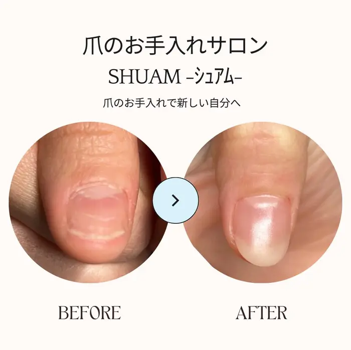 shuam えむ(爪のお手入れサロン shuam -ｼｭｱﾑ-所属)のネイルサロン・ネイリスト情報｜ミニモ